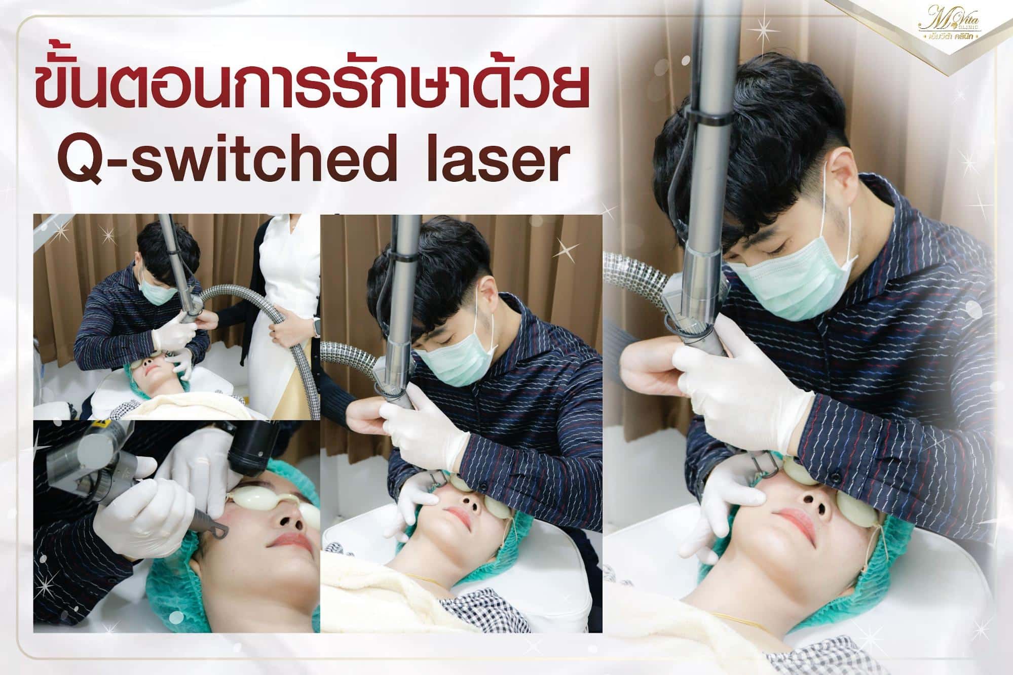 Q-Switch Laser คืออะไร รักษาอะไรได้บ้าง ข้อดีข้อเสียคืออะไร?