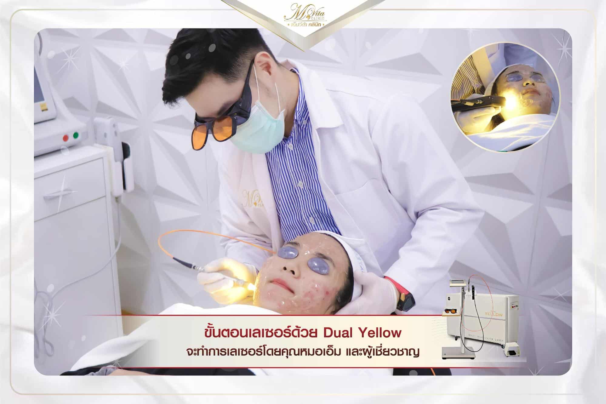 รู้จัก Dual Yellow Laser คืออะไร? ดีไหม? ทำกี่ครั้งเห็นผล?