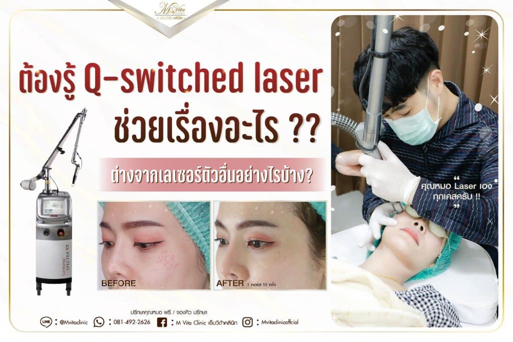 ต้องรู้ Q-switch laser ช่วยเรื่องอะไร ต่างจากเลเซอร์ตัวอื่นอย่างไรบ้าง?