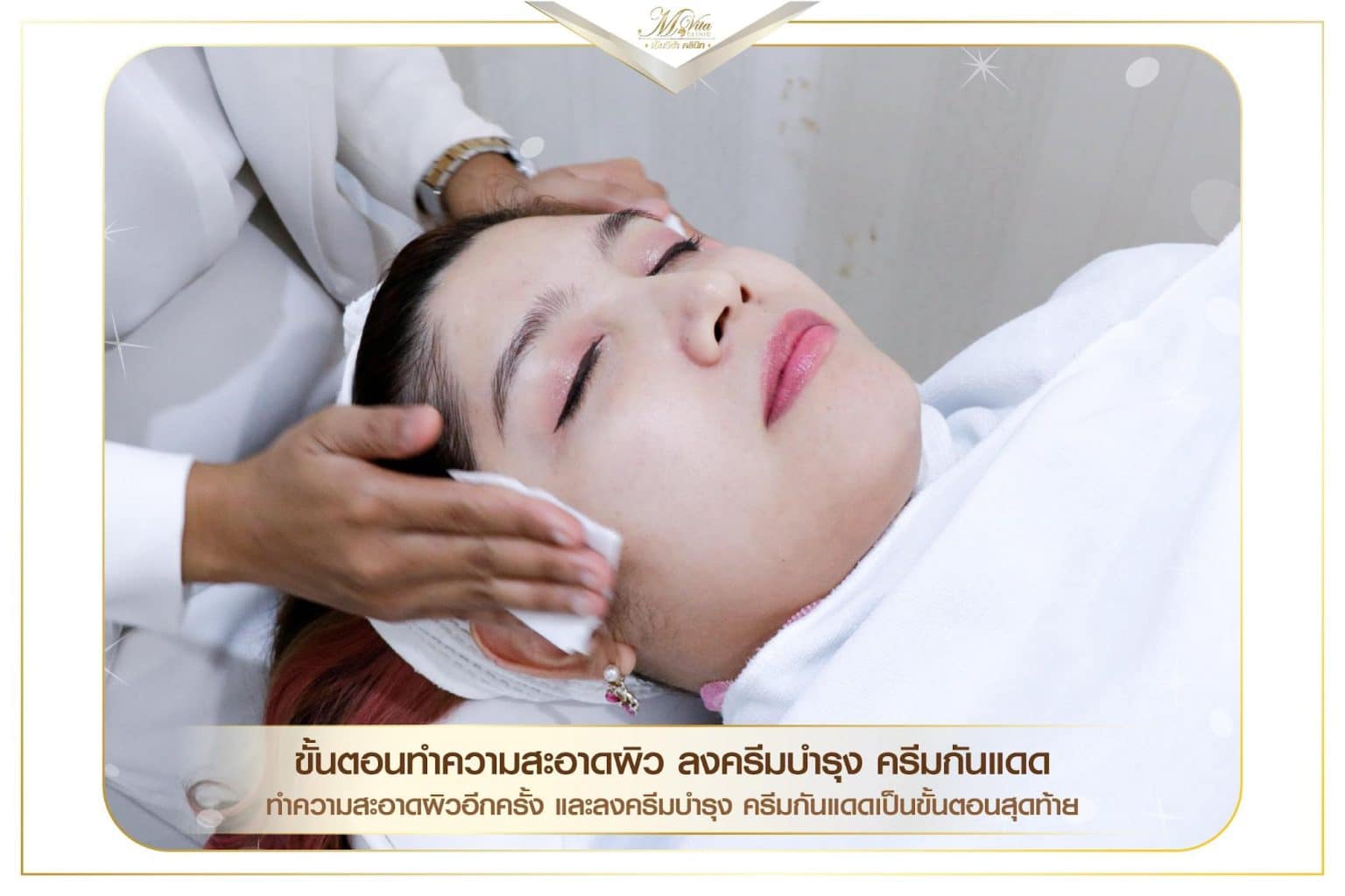 QuadroStar Pro Yellow Laser รักษารอยสิว แก้ผิวให้สวยใส