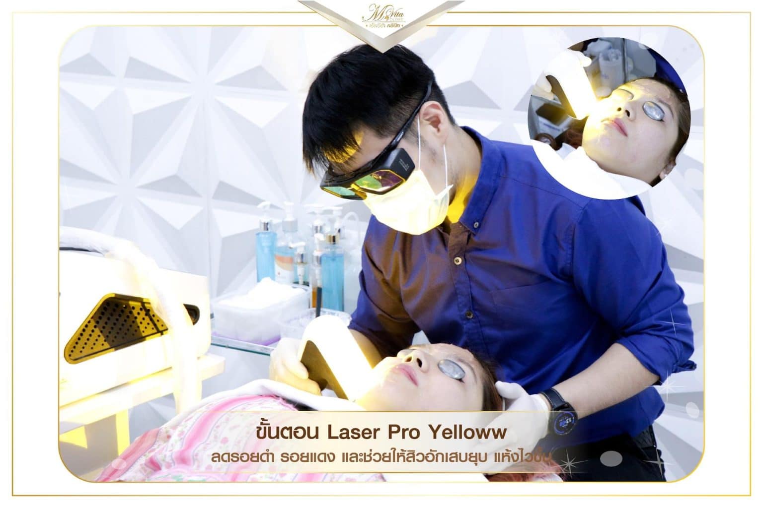QuadroStar Pro Yellow Laser รักษารอยสิว แก้ผิวให้สวยใส