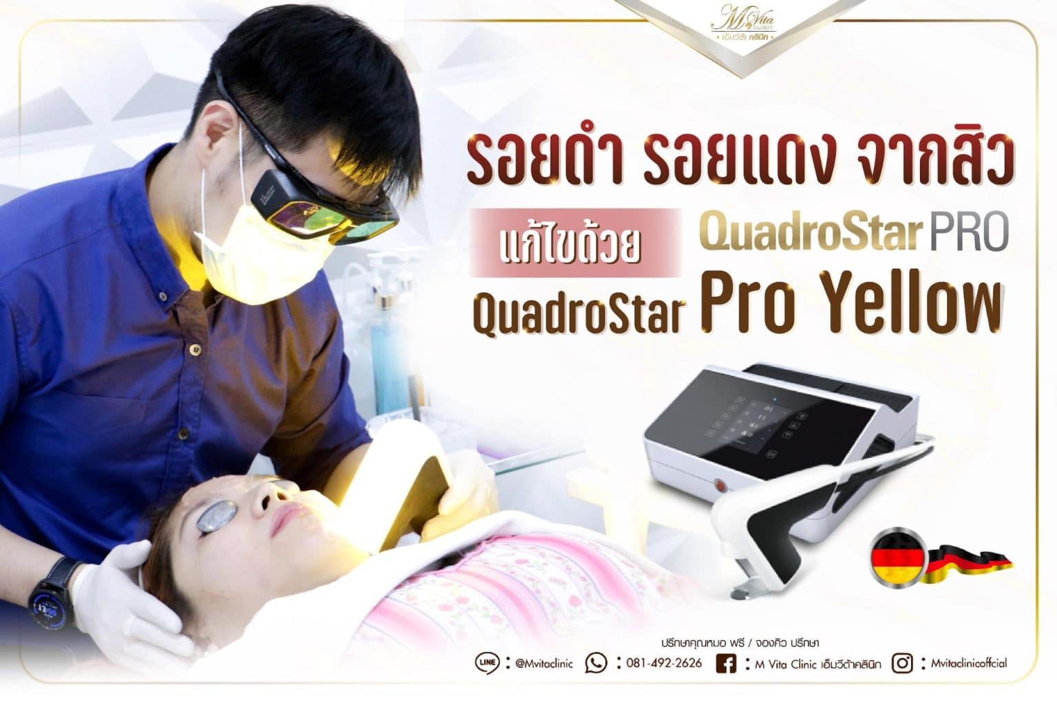 QuadroStar Pro Yellow Laser รักษารอยสิว แก้ผิวให้สวยใส