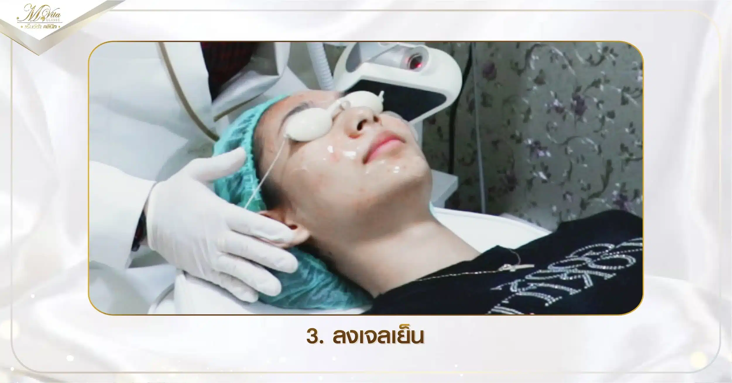 Dual Yellow Laser Vs QuadroStarPro Yellow คืออะไร?