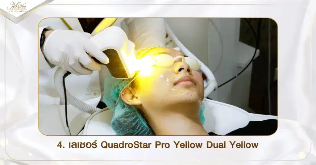 Dual Yellow Laser Vs QuadroStarPro Yellow คืออะไร?