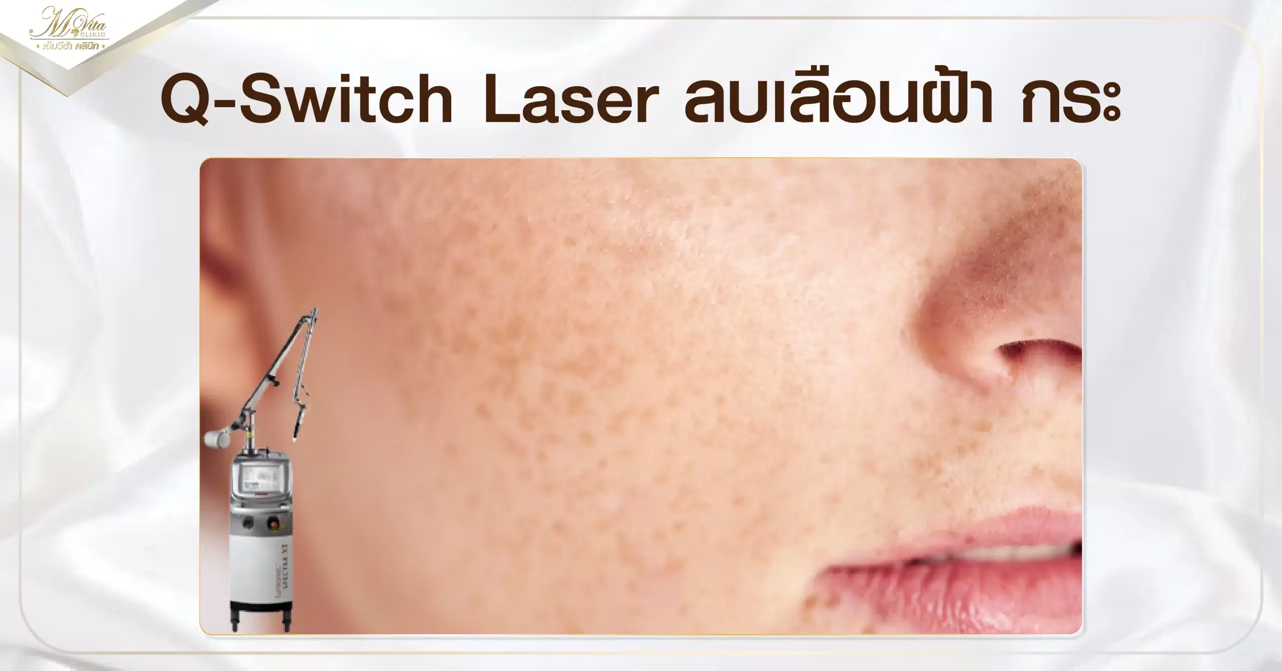 Q-Switch Laser คืออะไร รักษาอะไรได้บ้าง ข้อดีข้อเสียคืออะไร?