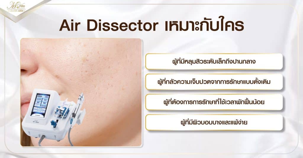 Air Dissector คืออะไร ตัดผังผืดด้วยแรงดันอากาศดีหรือไม่